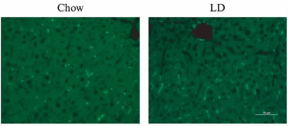 清道夫受体A基因敲除对小鼠肝脏代谢及胆囊结石形成的影响
