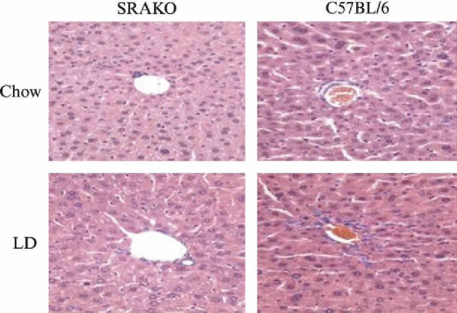 清道夫受体A基因敲除对小鼠肝脏代谢及胆囊结石形成的影响